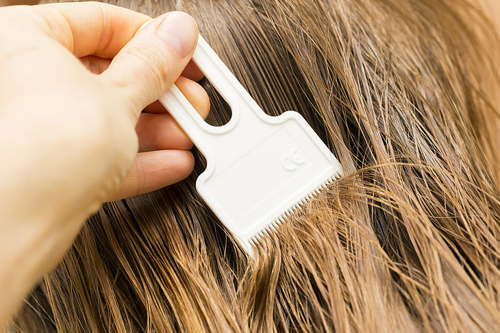 Wszawica u dzieci - jak wyglądają wszy i gnidy. Leczenie i profilatyka ...